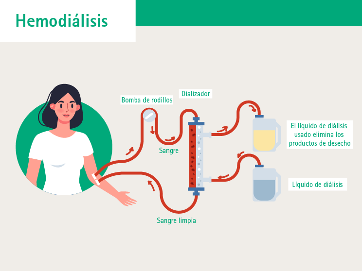 Diálisis: Un cuidado que salva vidas - B. Braun